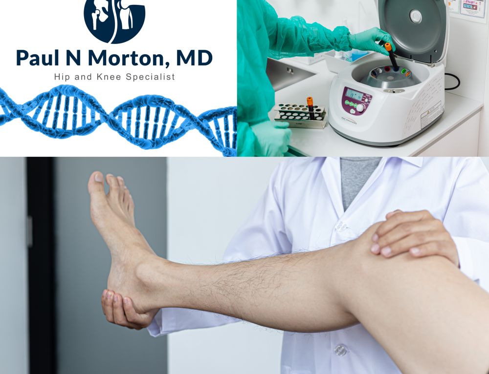 Rheumatologist Vs. Orthopedic Surgeon Which Should I See?